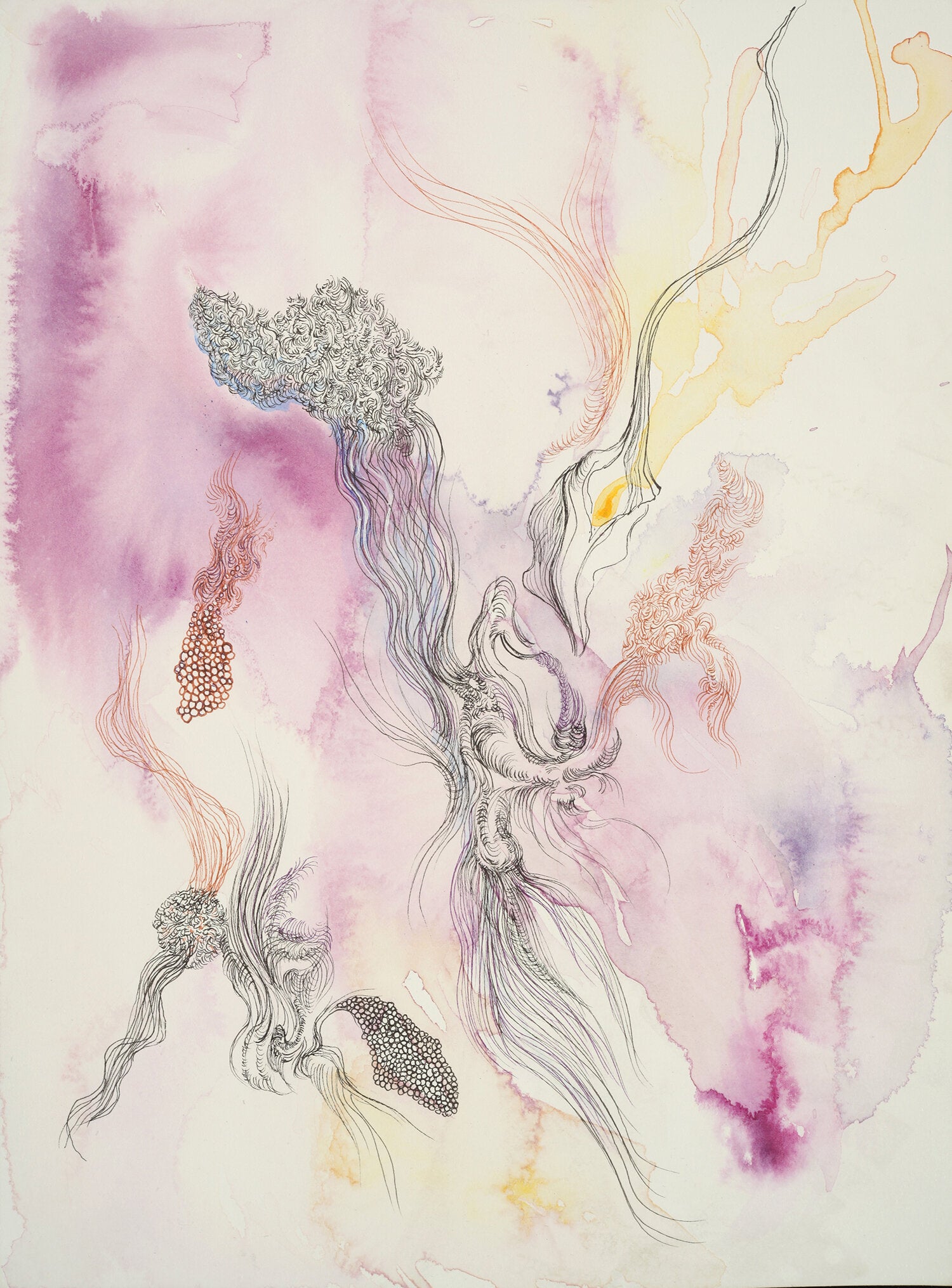 Cavernous Malformations #18 – Drawing Room SF